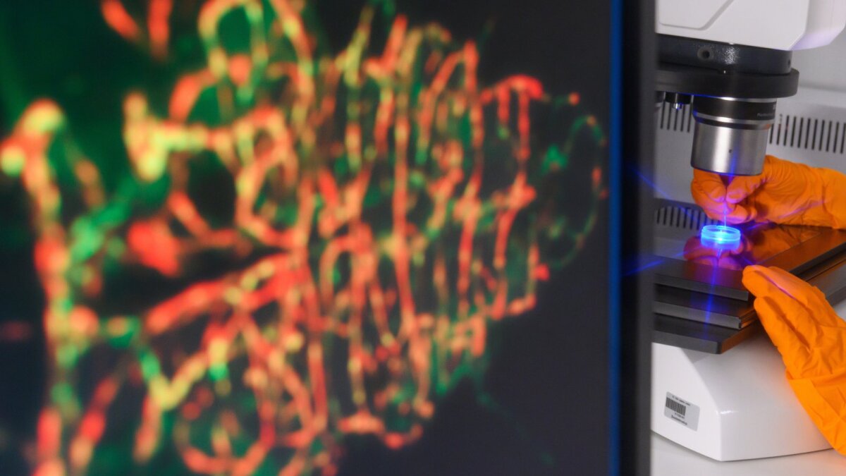 Aging in model organisms